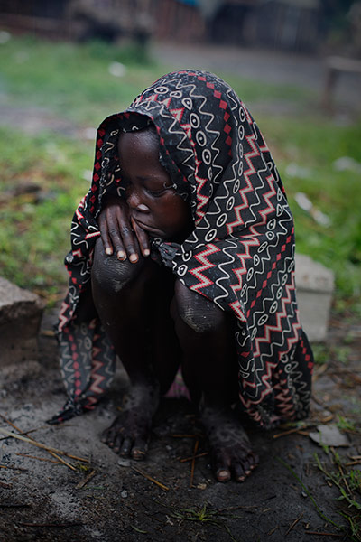South Sudan: medical experts in Gumuruk village…