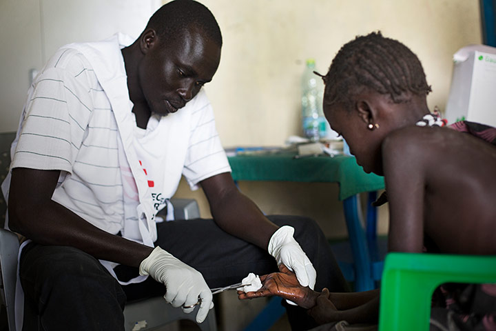South Sudan: medical experts in Gumuruk village…